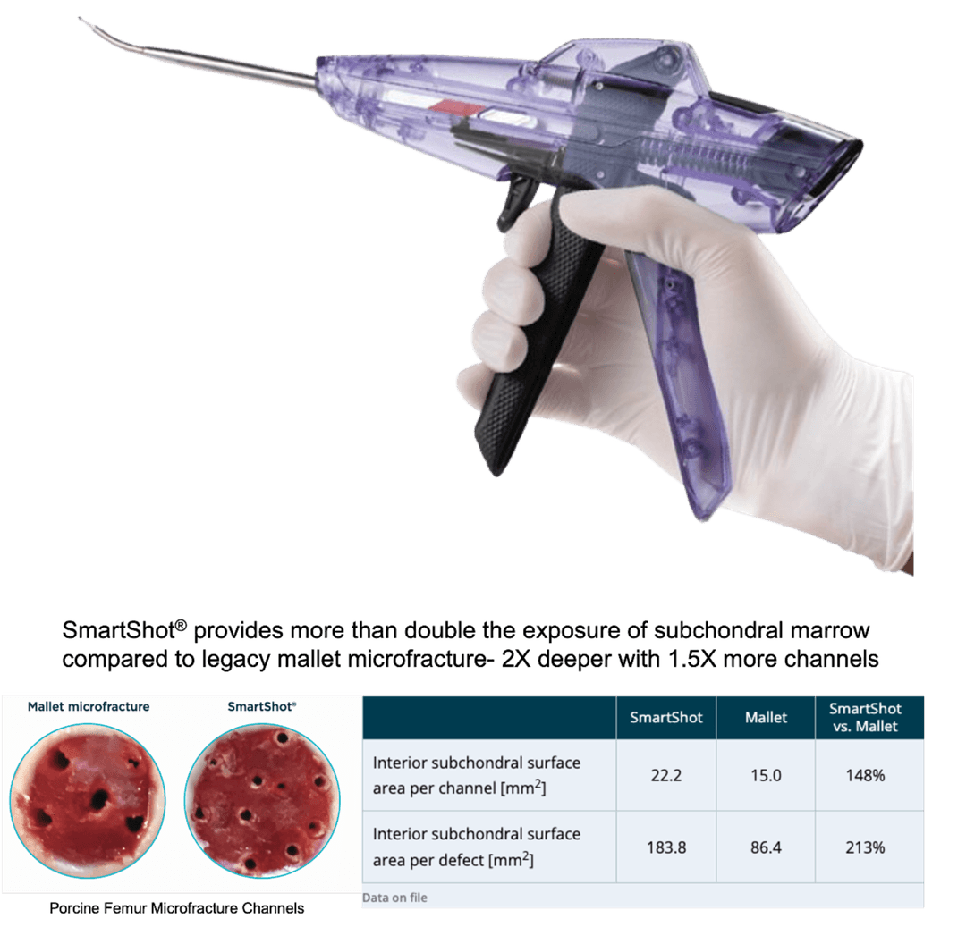 Single-use Sterile Medical Devices | Spartan Medical